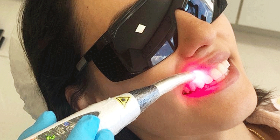 O uso de laser na odontologia e seus benefícios - Centro Conscientia